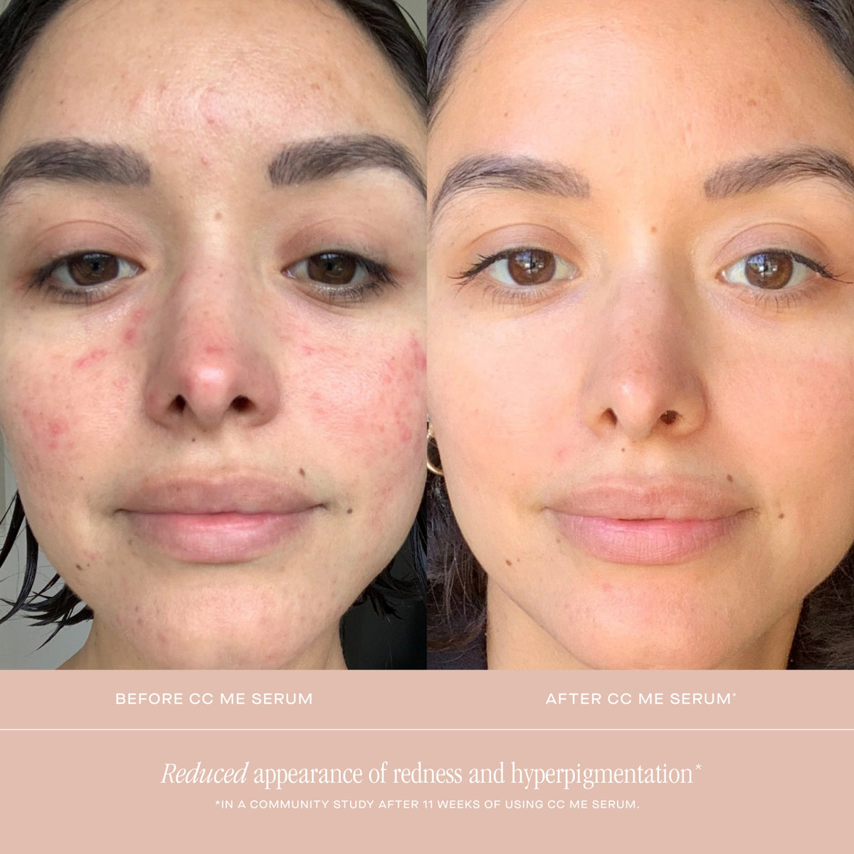 CC Me Vitamin C Serum | Summer Fridays